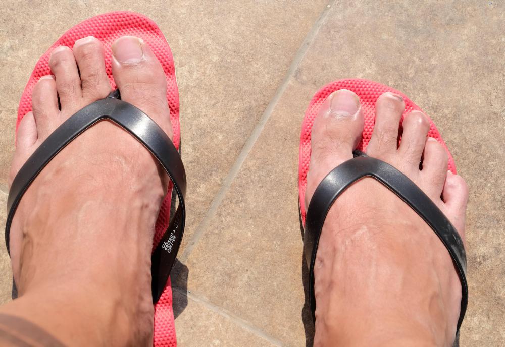 What are the Different Types of Slippers? (with pictures)