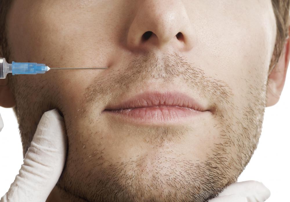 What is a One-Hour Face Lift? (with pictures)