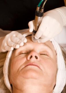 What Are the Pros and Cons of Electrolysis for Eyebrows?
