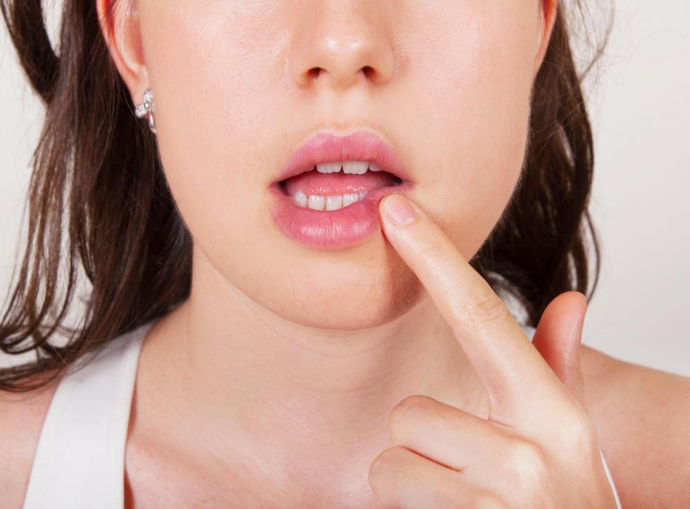 What Is a Lip Freckle? (with pictures)